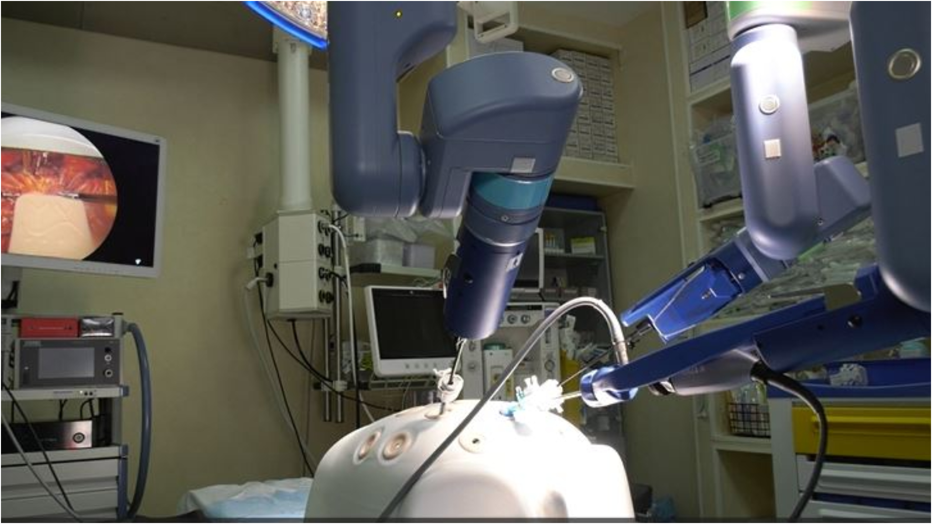 Primul robot chirurgical pentru intervenții pediatrice într-o unitate ...